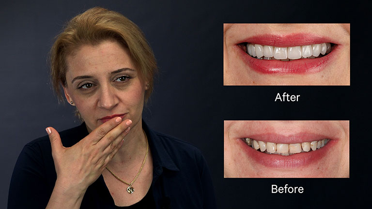 Natasha - Transformation - Infinite Smiles - Neal Patel, D.D.S., Inc.
